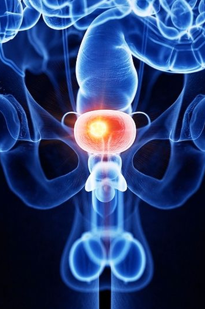 Κυστεοσκόπηση (Κλασική και Φωτοδυναμική) – Νικόλαος Δ. Κολίτσας